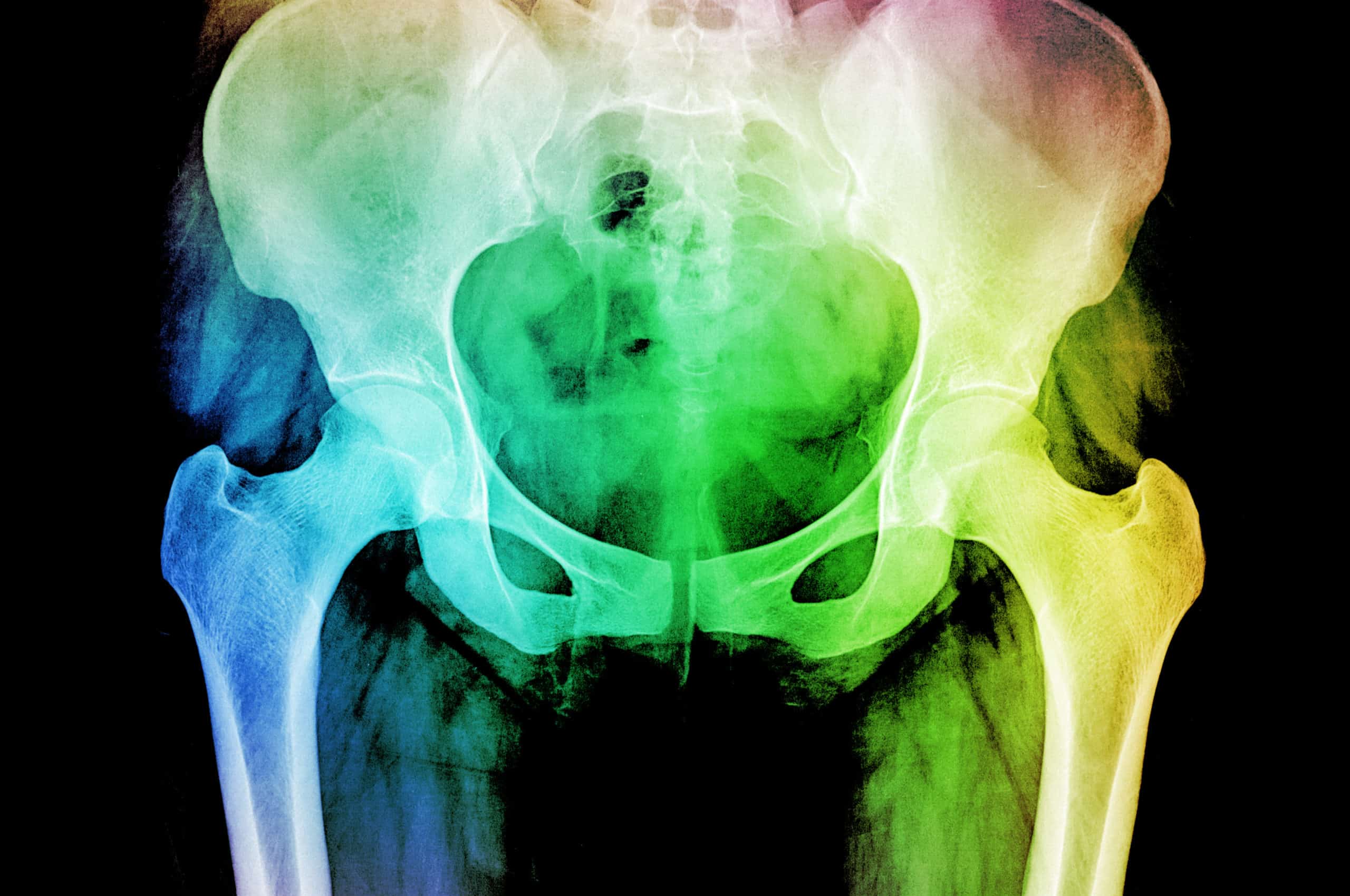 Massive gaps in radiotherapy follow up care