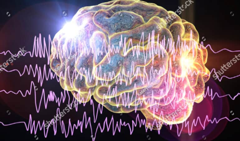 GOSH: new epilepsy research reveals brain wiring differences