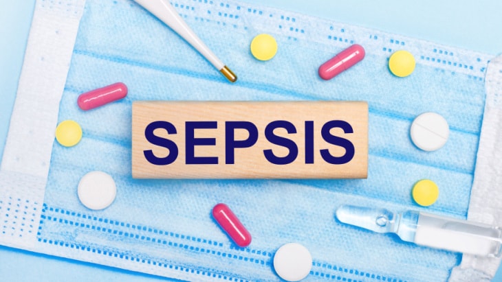 Sepsis Research FEAT