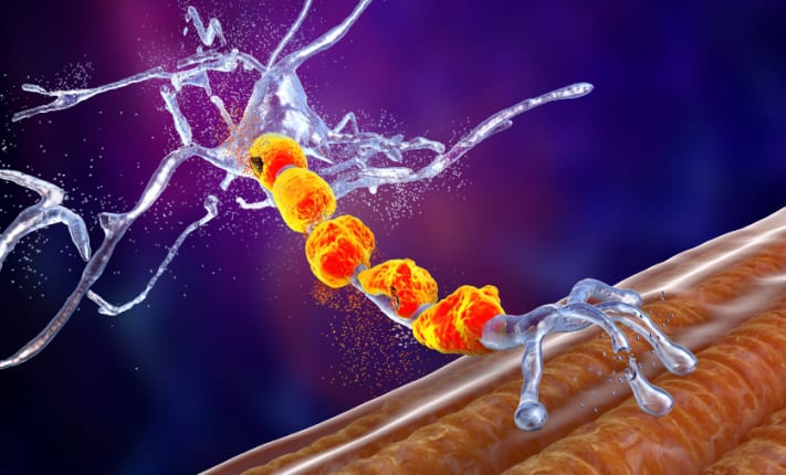 Advances In Motor Neuron Disease Treatments