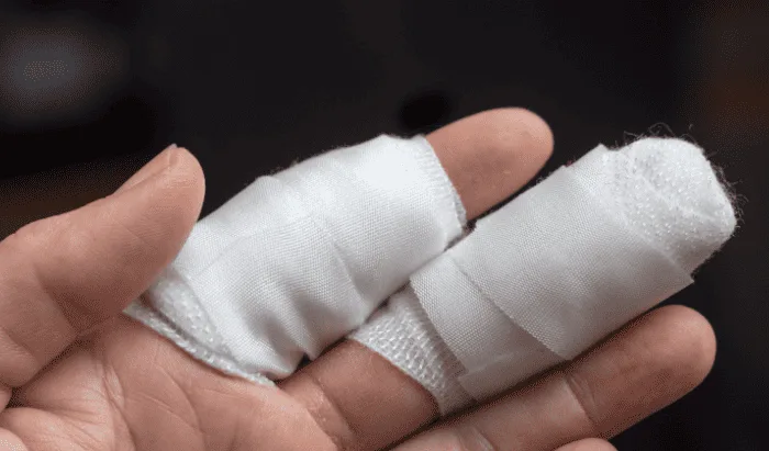 What to do if someone cuts their finger off