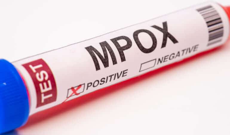 Preventing an mpox resurgence this summer - The Hippocratic Post