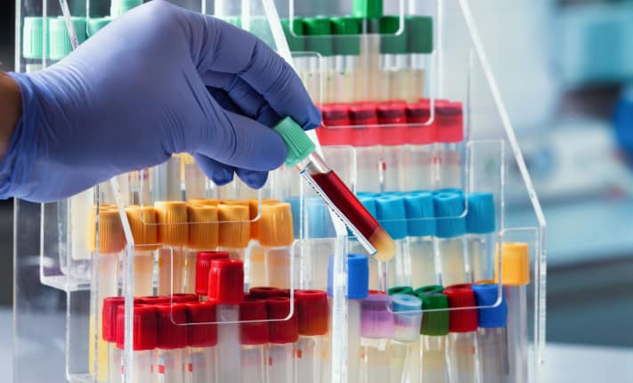 Biobank for children with genetic muscle diseases