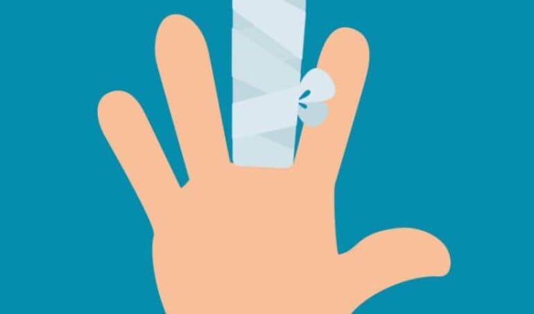 Amputated, bruised and crushed fingers: What to do